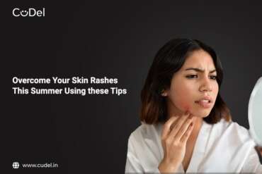Overcome Your Skin Rashes This Summer Using These Tips